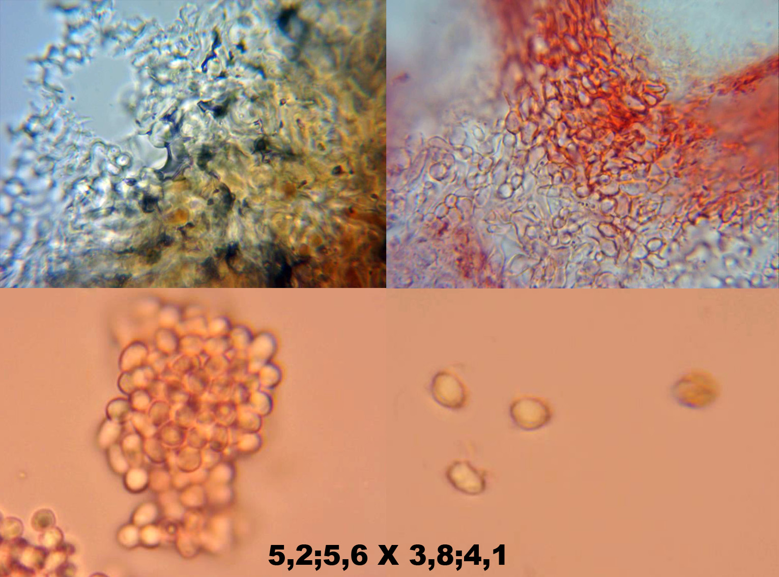 Hypocrea rufa. Un ascomiceto al microscopio - Foro de micología